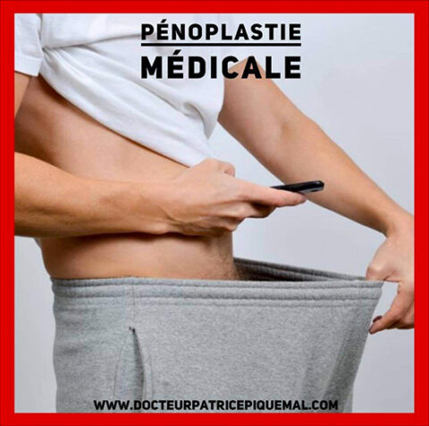 MEDICAL PENOPLASTY - Docteur Patrice piquemal
